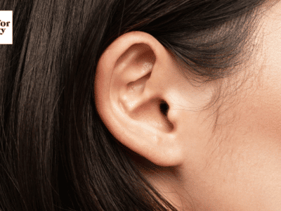 Earlobe Cyst - How To Get Rid Of A Lump In EarLobe? | Bumps on Earlobe
