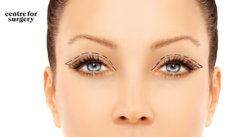 How To Fix Hooded Upper Eyelids | Centre for Surgery
